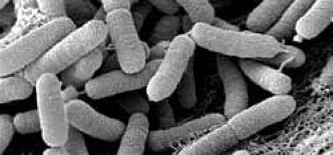 Xylella Fastidiosa Wikipedia La Enciclopedia Libre