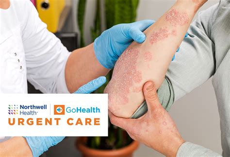 Skin Rashes And Ailments 10 Common Types The Well By Northwell