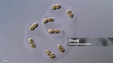 Algal Genus Glaucocystis And Limnococcus Cyanobacteria Under Microscope
