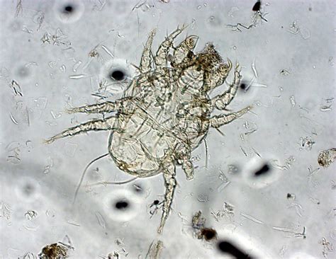 Cheyletiellosis Cat