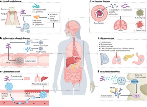 Fusobacterium Nucleatum Ecology Pathogenesis And Clinical