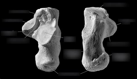 Diagram Of Right Calcaneus 1 Quizlet