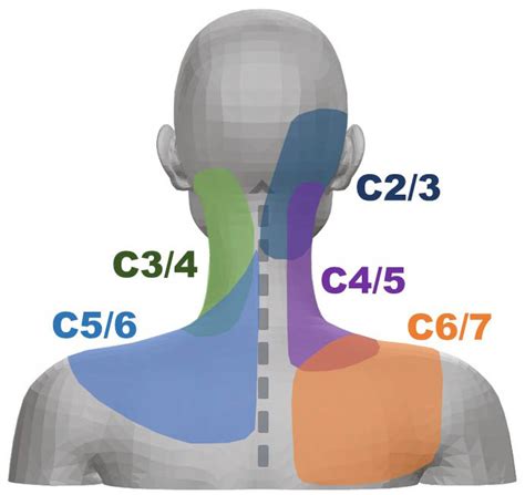 Facet Joint Pain Icd 10 At Christy Nathan Blog