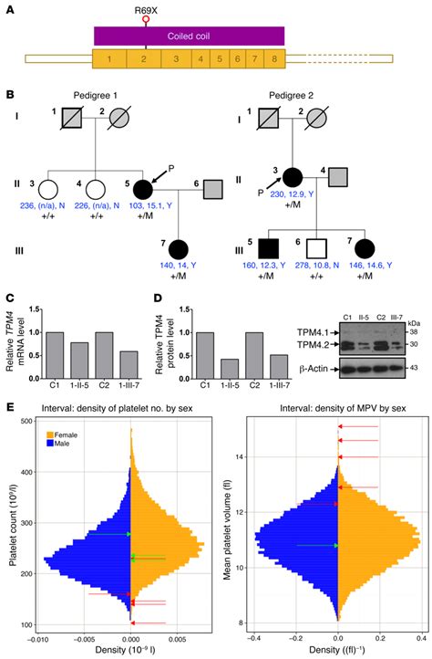 Tpm4 Mutation Causes Macrothrombocytopenia In Humans A Schematic
