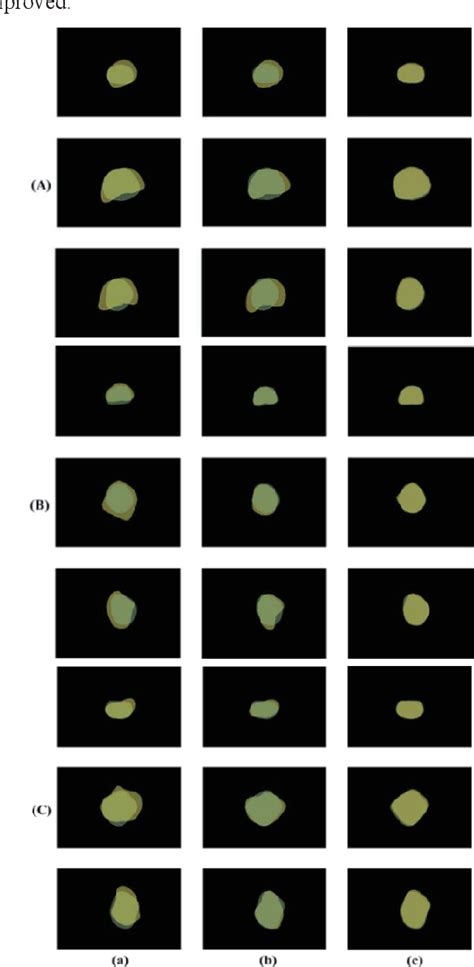 Figure 6 From Prostate Mritrus Image Registration Algorithm Based On Weak Supervision