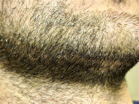 Close Up Of A Beard Showcasing Coarse Hair Texture And Detail Highlighting Facial Grooming And