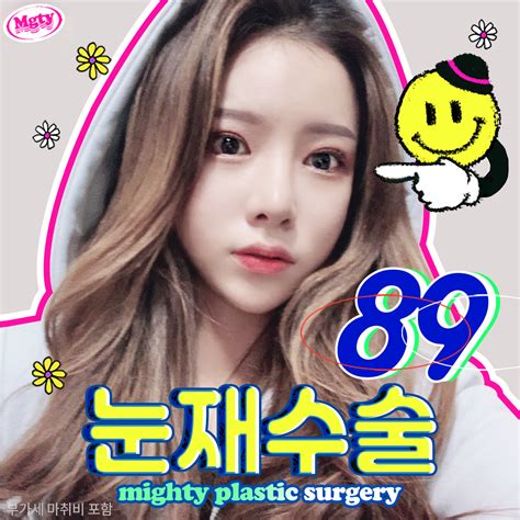 마이티 성형외과 눈재수술89만원