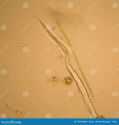 Pond Water Plankton And Algae At The Microscope Nostoc Commune Stock