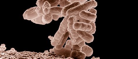 Escherichia Coli O157h7 Unl Food Nebraska