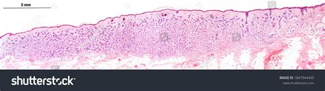 5122 Cutanous Royalty Free Photos And Stock Images Shutterstock