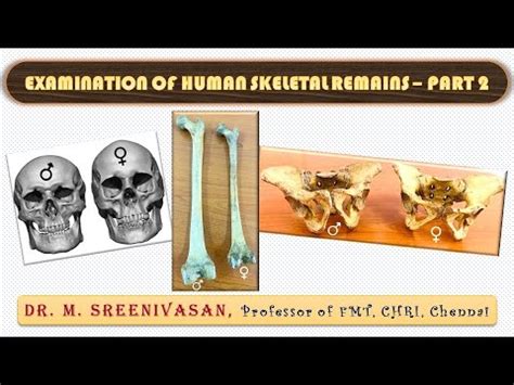 SEX DIFFERENTIATION IN HUMAN SKULL PELVIS FEMUR PRACTICAL VIVA YouTube