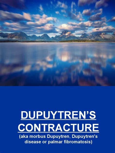 Understanding Dupuytrens Contracture Pdf Causes Of Death Medicine