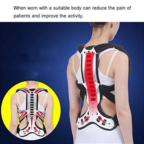 Thoracic Kyphosis Correction Specialized Expertise For Spinal