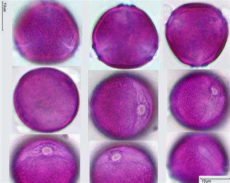 Datei Vitis Vinifera Tricolporat  Pollen Wiki