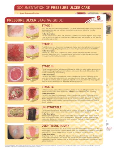 Pressure Ulcer Staging Guide Pressure Management Guide