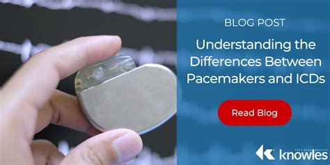 Understanding The Differences Between Pacemakers And Icds Jf Kilfoil