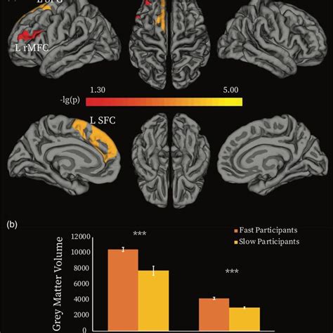 Functional Connectivity Differences Between Fast And Slow Participants