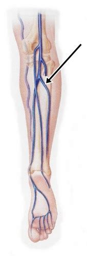 Anatomy Lab 6 Veins Of The Lower Extremity Flashcards Quizlet