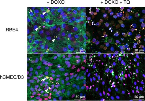 Intracellular Distribution Of Doxorubicin In Rbe4 Wildtype And