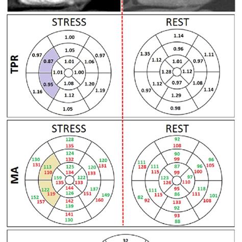 Quantitative Myocardial Perfusion Analysis A Myocardial Perfusion Download Scientific