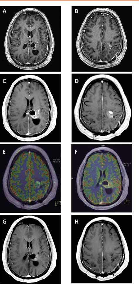 Novottf 100a Device Semantic Scholar