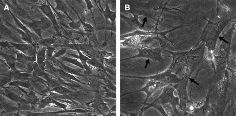 Cellular Morphology Of Mesenchymal Stem Cells Mscs In Early And