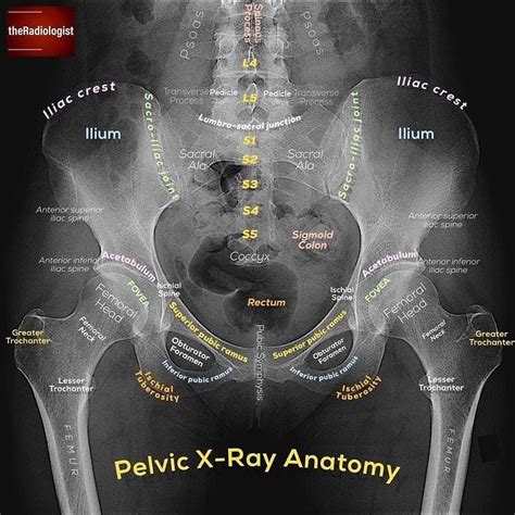 Anatomía De La Pelvis