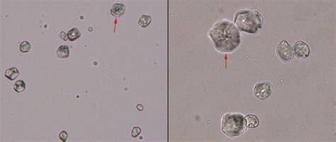 Granular Starch Medical Laboratories