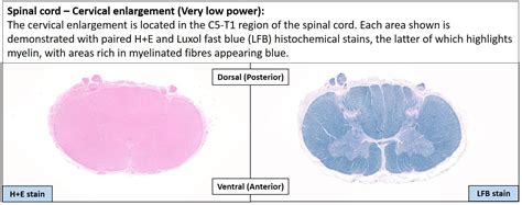 Cervical Spinal Cord Histology Cervical Spinal Cord Histology