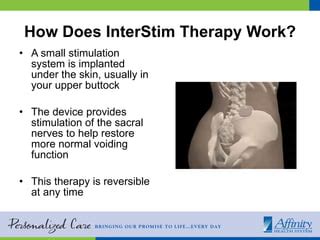 Taking Control Of Urinary Incontinence Ppt