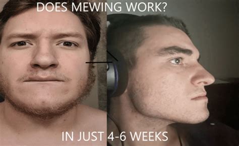 Mewing Meme Mewing Discover And Share S