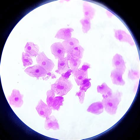 Vaginal Epithelial Cells Rmicroscopy