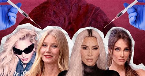 De Comer Placenta A Inyectarse Su Propia Sangre Los Tratamientos Más Bizarros De Las Famosas