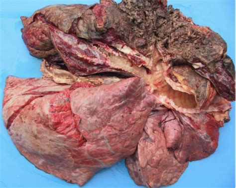 Cont Bronchopneumonia And Interstitial And Bronchointerstitial Disease Flashcards Quizlet