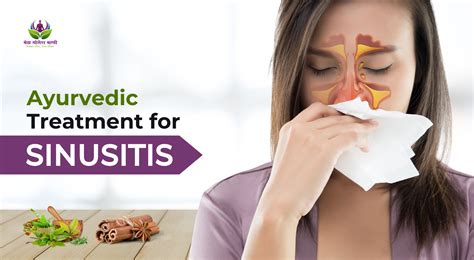 Sinusitis Ayurvedic Remedies Guide Dr Yogesh Vani