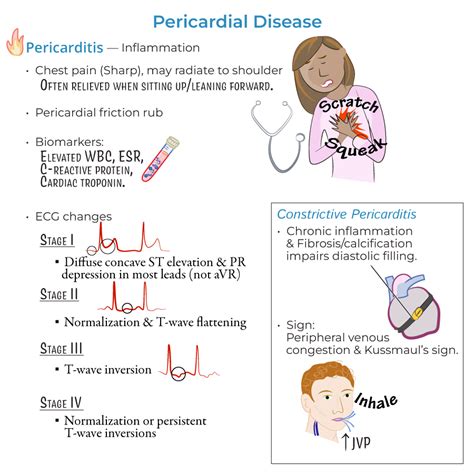 Clinical Pathology Glossary Pericardial Diseases Ditki Medical And Biological Sciences