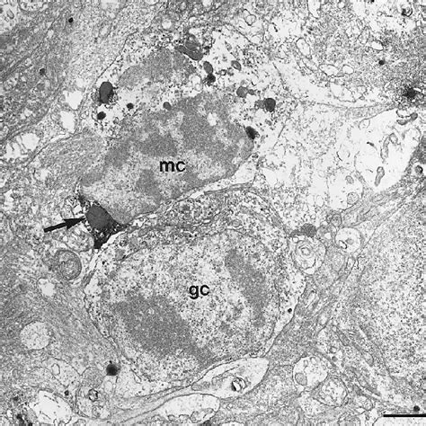 Electron Micrograph Of A Transcellularly Labelled Microglial Cell Mc