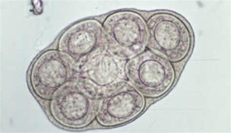 Parasitology Lab Id Flashcards Quizlet