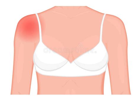 Human Body Problemhoulder Pain In Woman Stock Vector Illustration Of