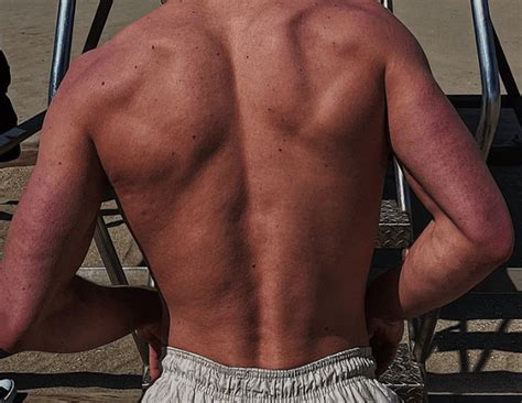 Insulin Absorption Problem Rdiabetest1