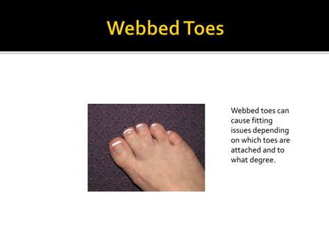Ppt Common Foot Pathologies And Deformities Powerpoint Presentation