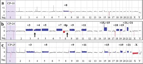 Large Chromosomal Aberrations Detected By Acgh Analysis A Whole