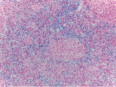 Special Stain Perls Diapath