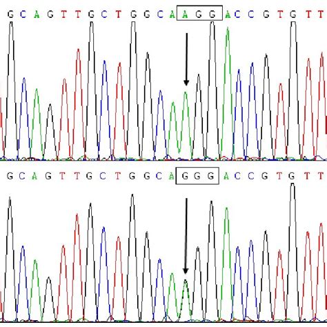 Sequence Electropherograms Exhibiting The Wild Type And Heterozygous