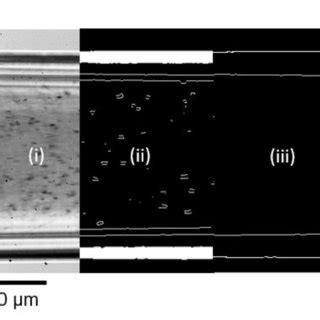 Summary Of Post Processing Steps To Obtain The Residual Film Thickness