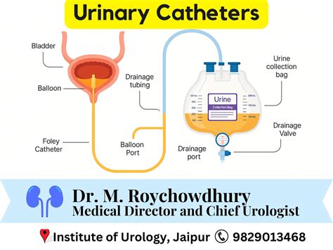 Haematuria Causes Diagnosis And Management