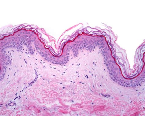 Human Skin Layers Histology