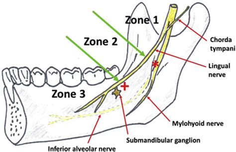Clinical Anatomy Of The Lingual Nerve A Review Journal Of Oral And