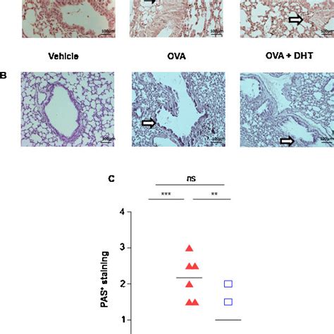 Effect Of Dht On Mast Cell Activation Following Allergen Sensitization