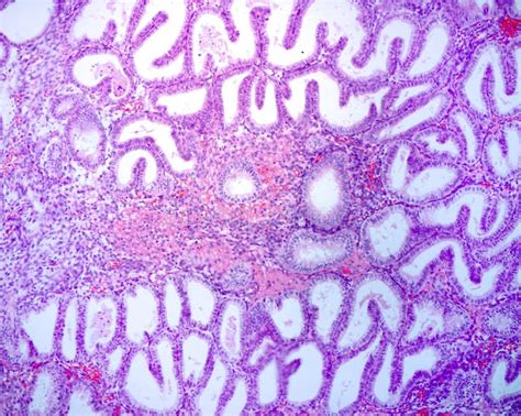 Endometrium Secretory Phase Stock Image Image Of Histology Endometrium 379802545